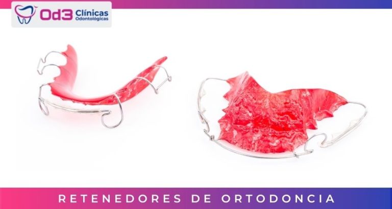 La importancia de usar retenedor de ortodoncia o placa de contención ...