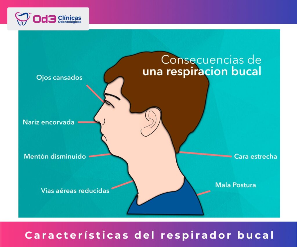 ¿Tu hijo duerme con la boca abierta ? – OD3 Clínicas Odontológicas